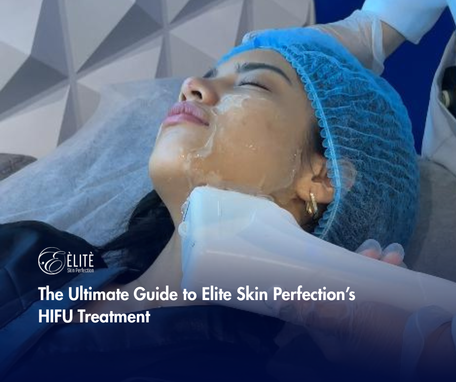 The Ultimate Guide to Elite Skin Perfection’s HIFU Treatment – Èlitè ...